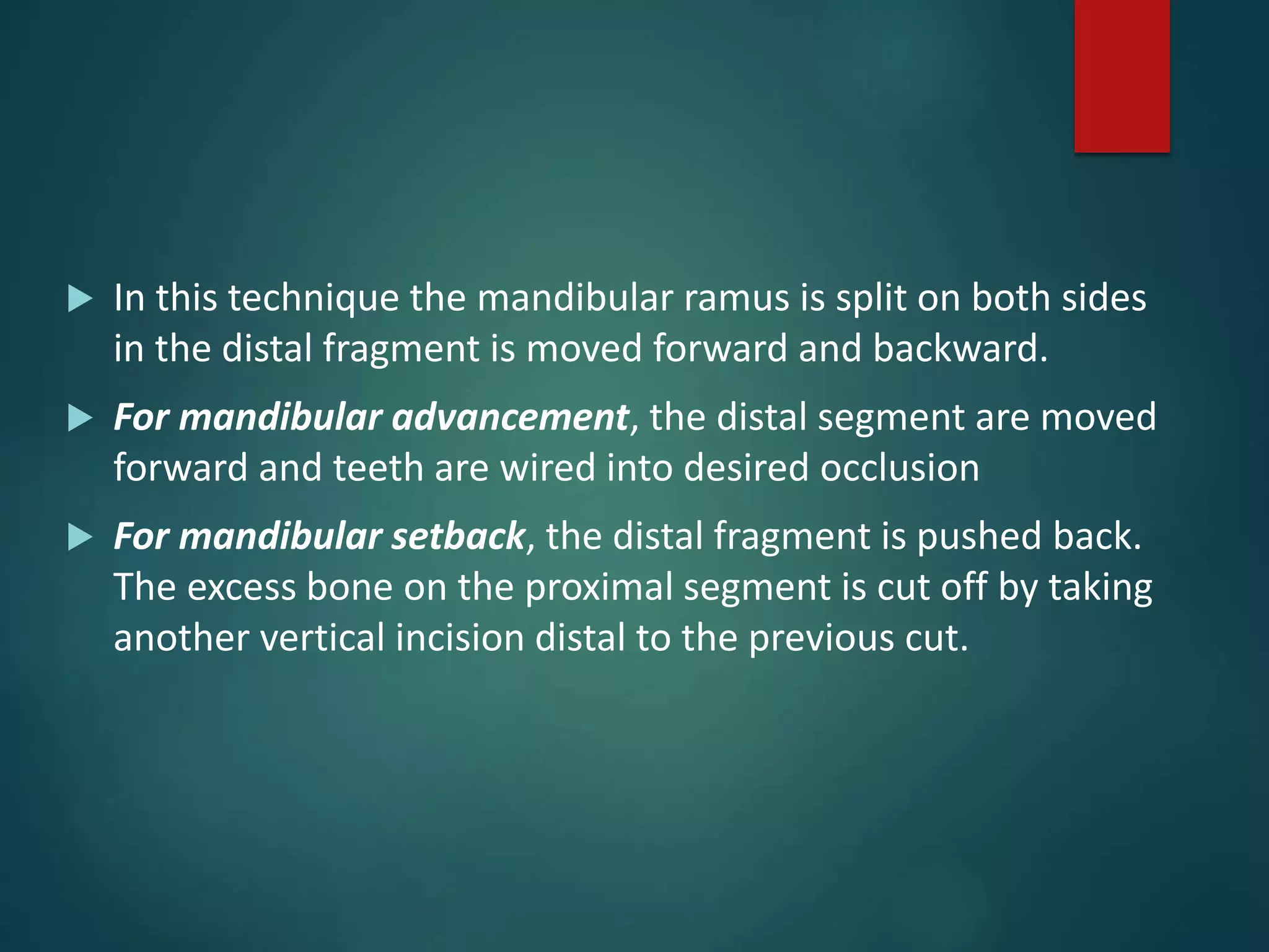 Major surgical procedures | PPTX