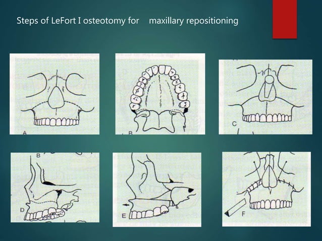 Major surgical procedures | PPTX | Dental Health | Diseases and Conditions
