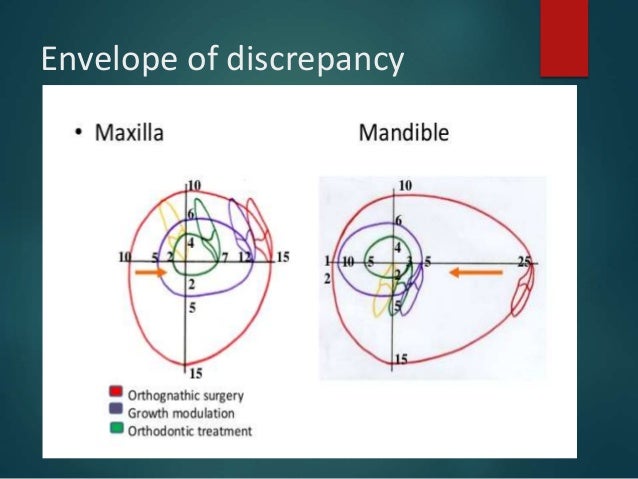 Major surgical procedures