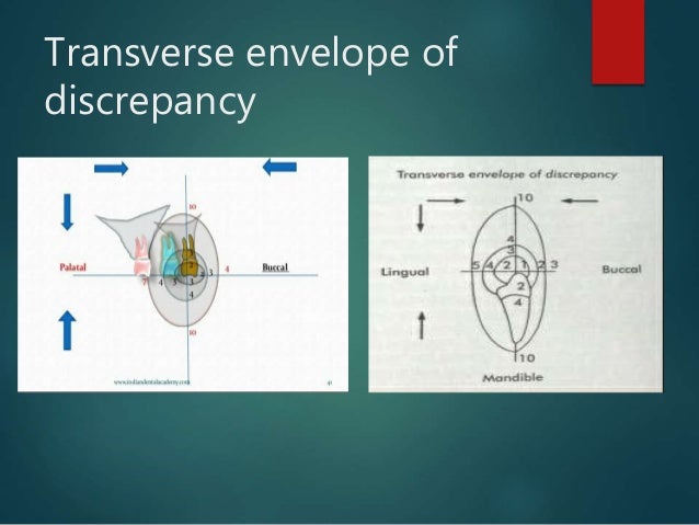 Major surgical procedures