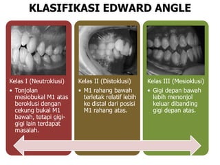 Makalah/Presentasi Kasus: Kepaniteraan Klinik Gigi & Mulut Universitas ...