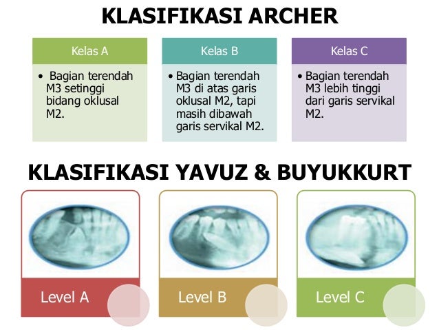 Makalah/Presentasi Kasus: Kepaniteraan Klinik Gigi & Mulut Universita…