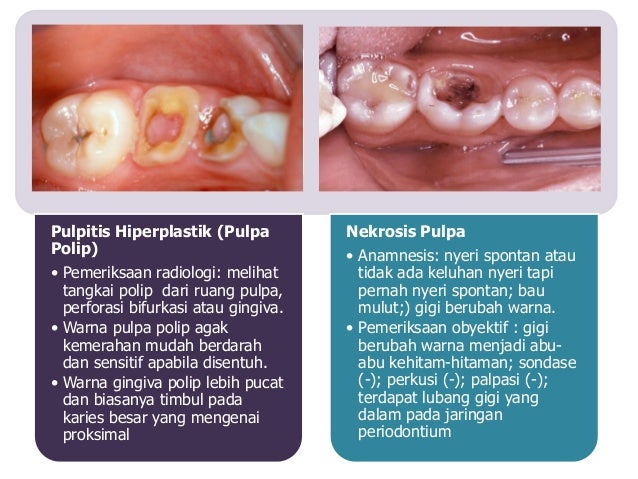 Makalah/Presentasi Kasus: Kepaniteraan Klinik Gigi & Mulut Universita…