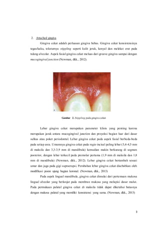 Makalah Gingiva | DOCX