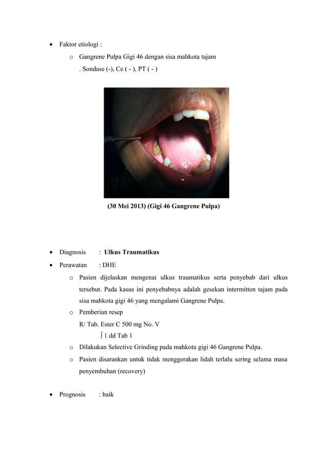 Traumatic ulcer and Fordcye's spot clinical case study (indonesian text ...