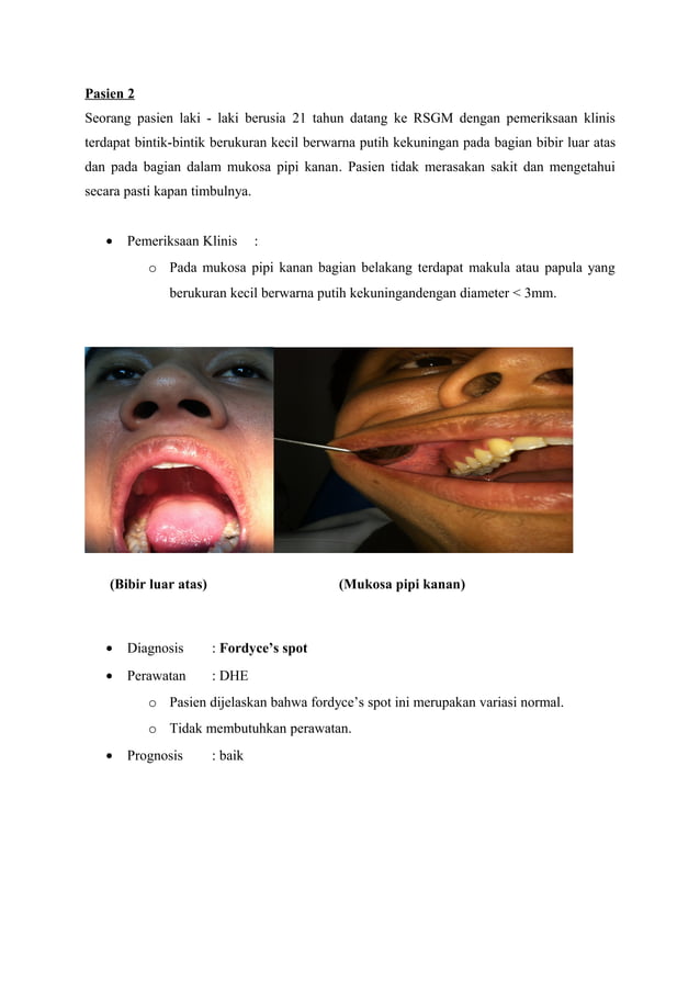 Traumatic ulcer and Fordcye's spot clinical case study (indonesian text ...