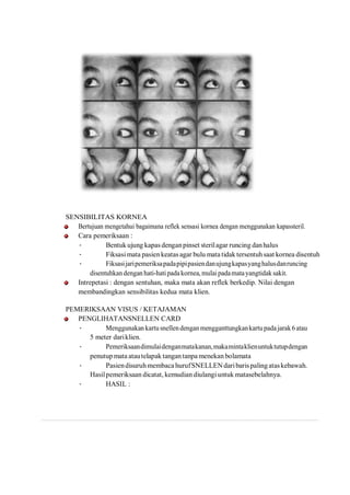 MAKALAH PEMERIKSAAN FISIK PERSEPSI SENSORIK KATARAK.pdf