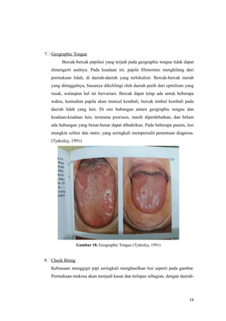 Makalah torus mandibula | RTF