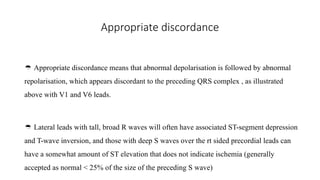 Making Sense Through series of ECG signs.pptx | Free Download