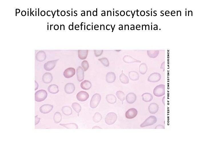 Making the diagnosis in hematology