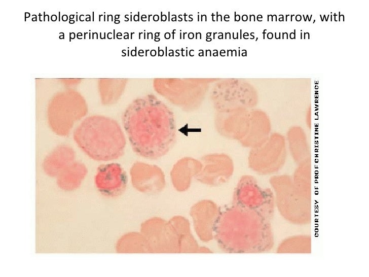 Making the diagnosis in hematology