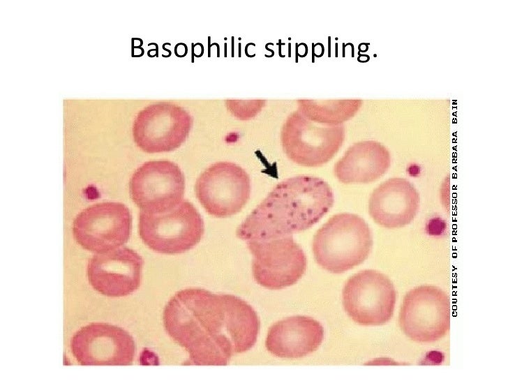 Making the diagnosis in hematology