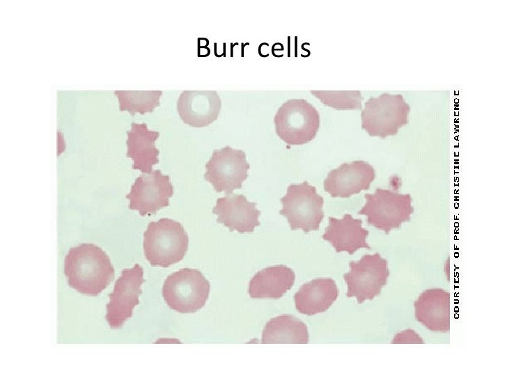 Making the diagnosis in hematology