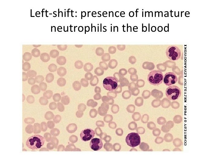 Making the diagnosis in hematology
