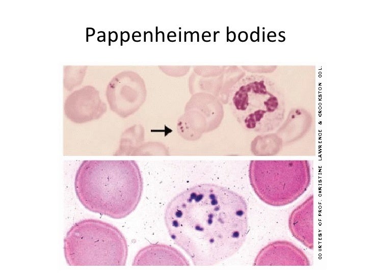 Making the diagnosis in hematology
