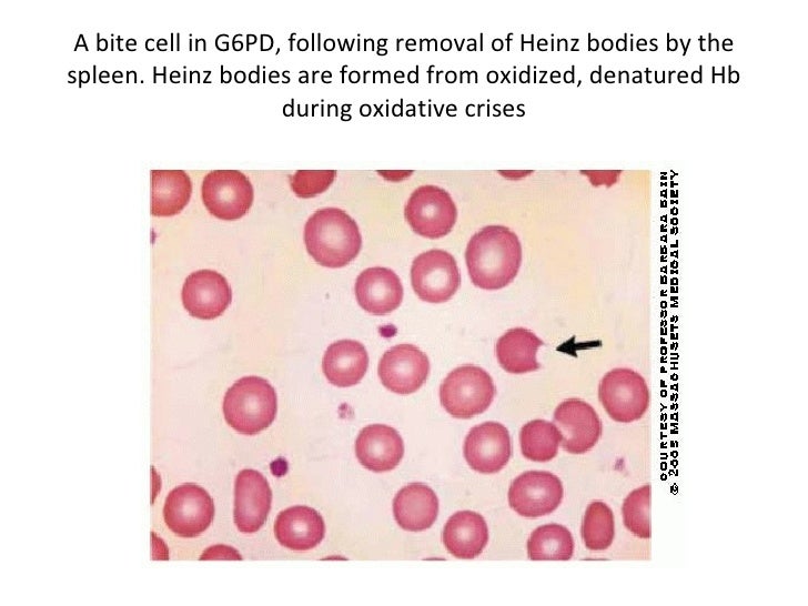 Making the diagnosis in hematology