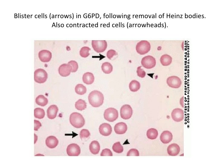 Making the diagnosis in hematology
