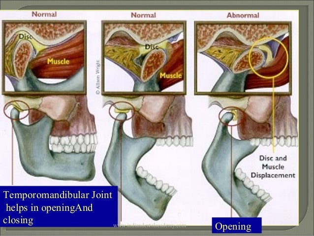 TMJ disorders/ General orthodontics
