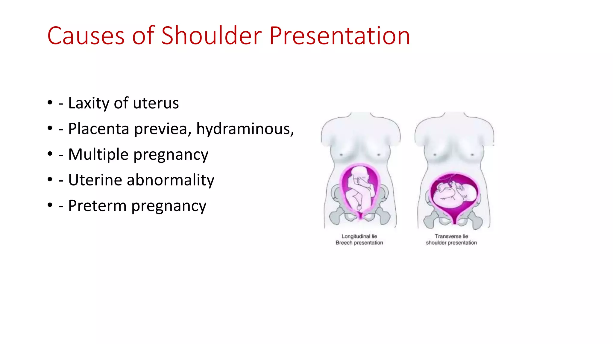 MAL-POSITION AND MALPRESENTATION PPT.pptx