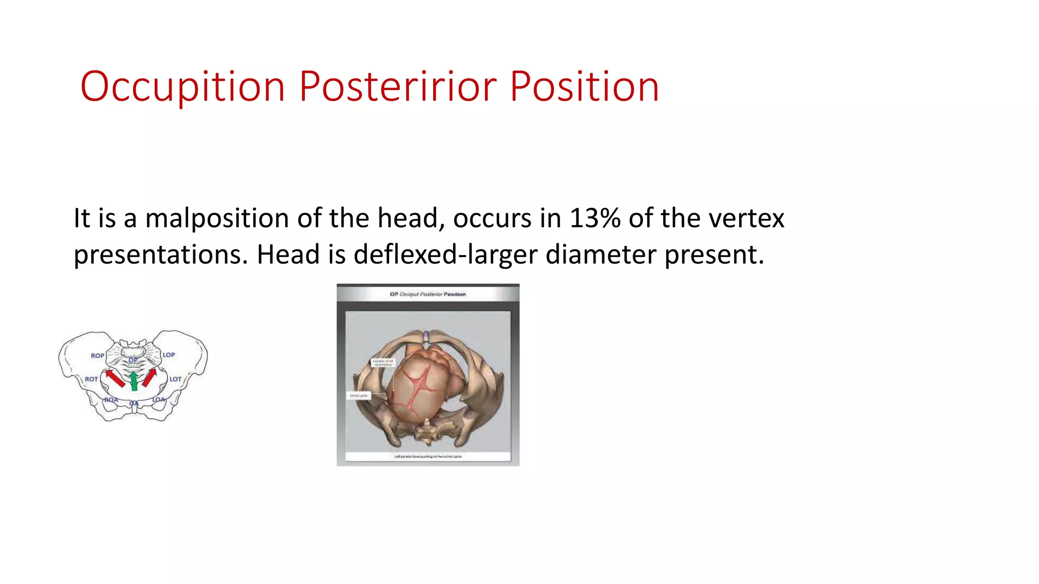 MAL-POSITION AND MALPRESENTATION PPT.pptx