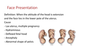 MAL-POSITION AND MALPRESENTATION PPT.pptx