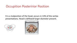 MAL-POSITION AND MALPRESENTATION PPT.pptx