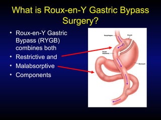 Malabsorbtion vs Restriction Post RNY Bypass | PPT
