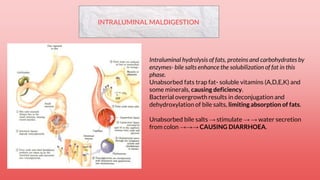 malabsorption.pptx