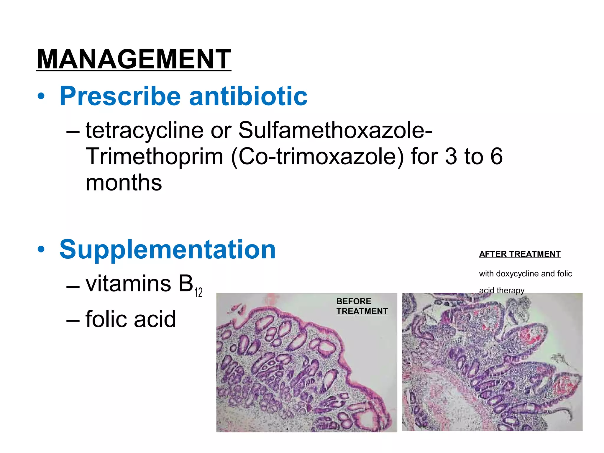 Malabsorption in tropical sprue & coeliac disease | PPT