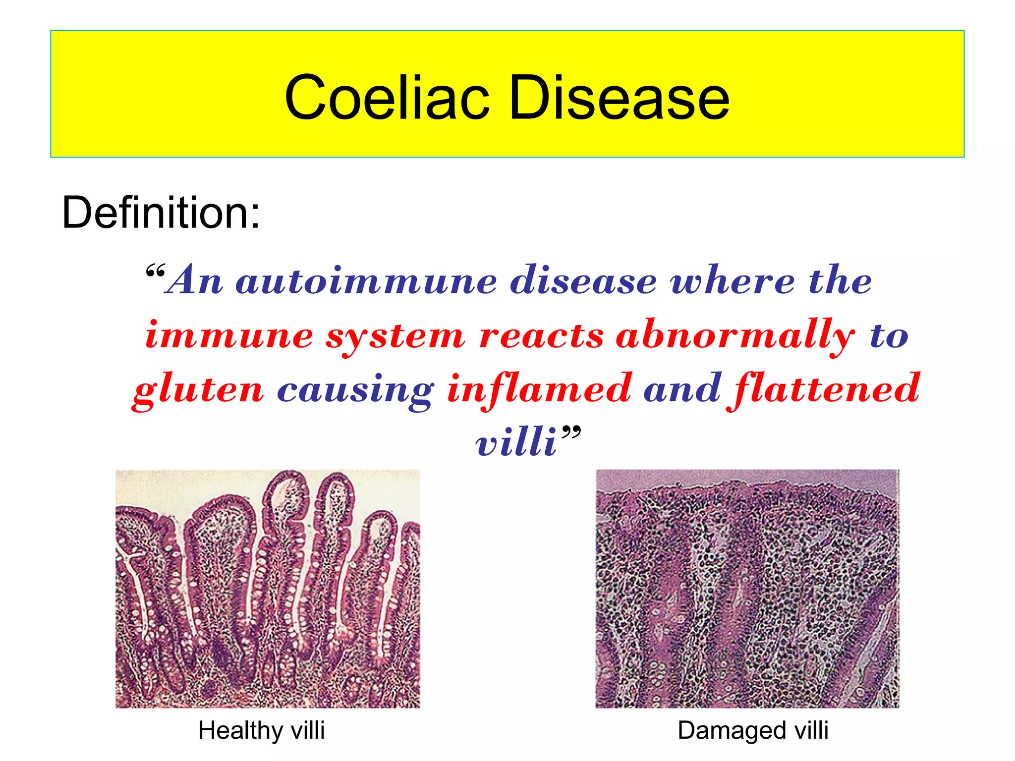Malabsorption in tropical sprue & coeliac disease | PPT