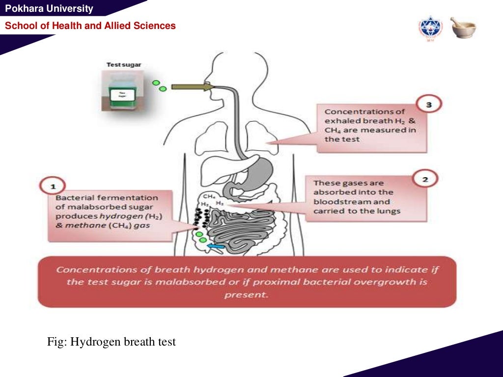 Malabsorption syndrome