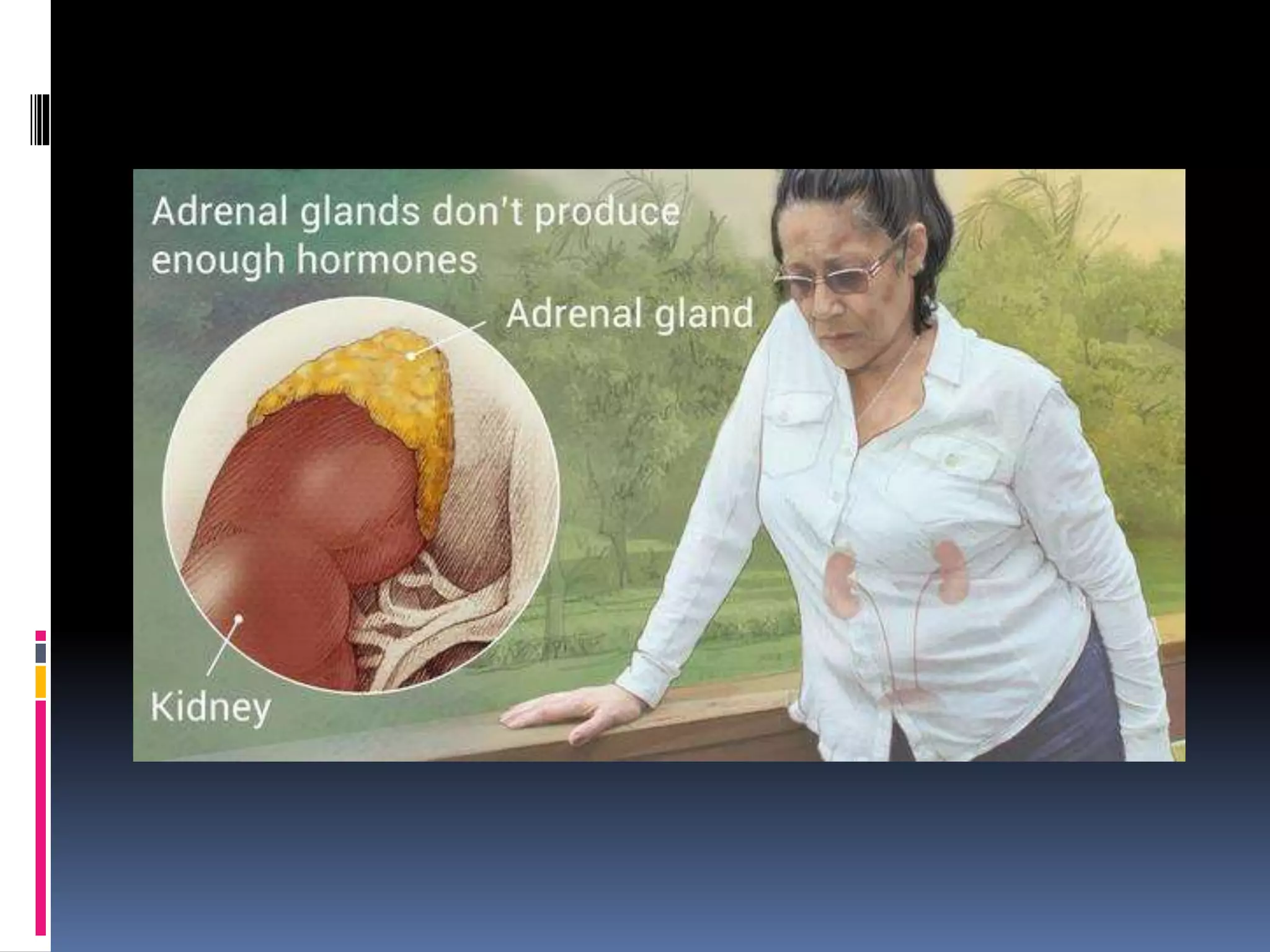 Malabsorption syndrome | PPTX