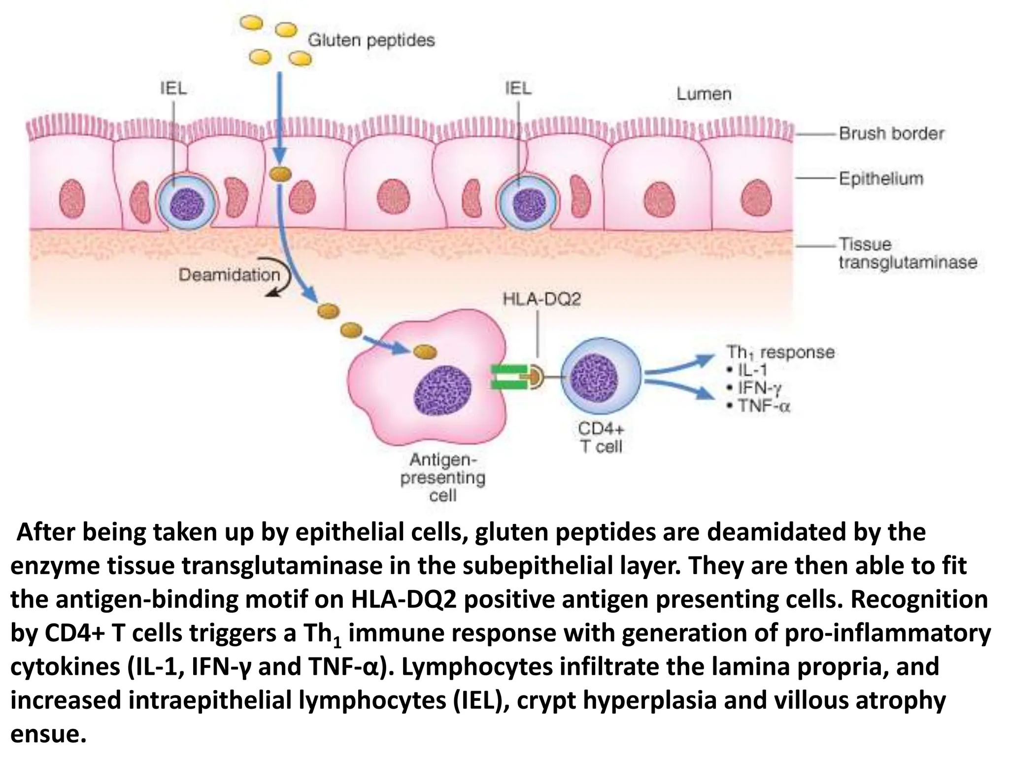 approach to Malabsorption Syndrome .pptx