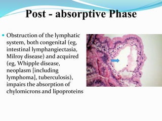 Malabsorption syndromes | PPTX | Digestive Disorders | Diseases and ...