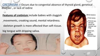 Thyroid gland and its disorders | PPTX