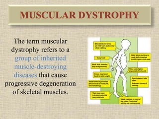 molecular markers in muscular dystrophy | PPT