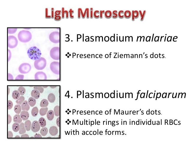 Malaria
