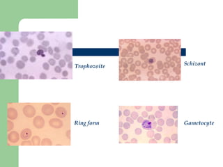 Malaria - 4 species | PPT