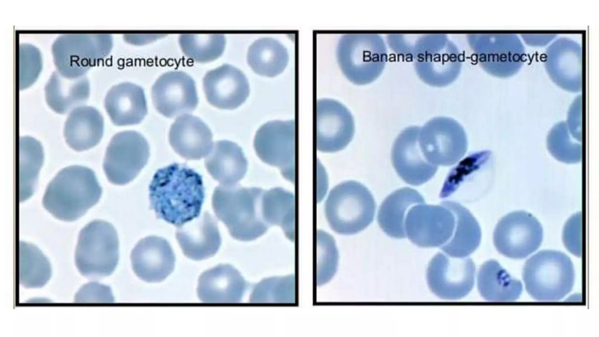 Malaria -causes| types| management -medical information | PPTX