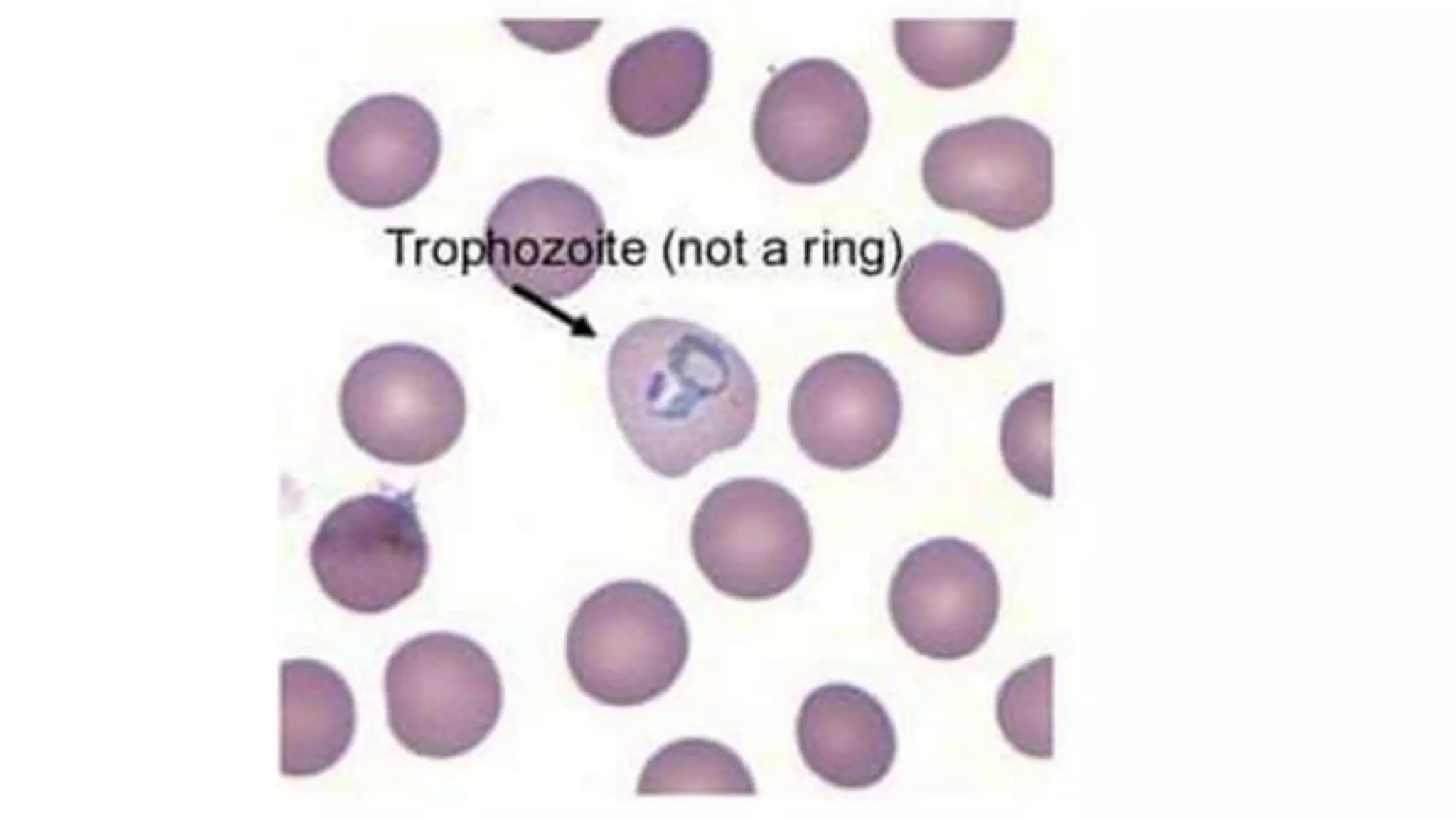 Malaria -causes| types| management -medical information | PPTX