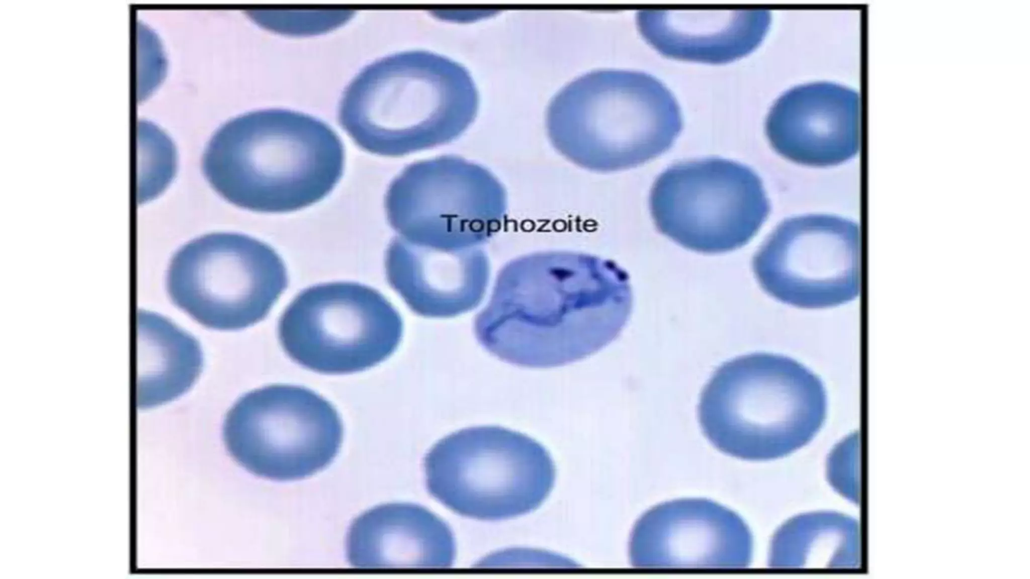 Malaria -causes| types| management -medical information | PPTX