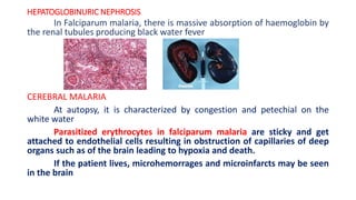 Malarial infection and pathological analysis | PPTX