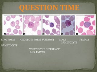malaria life cycle, patho physiology,lab diagnosis | PPTX