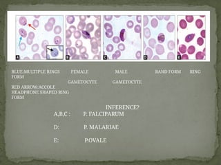 malaria life cycle, patho physiology,lab diagnosis | PPTX
