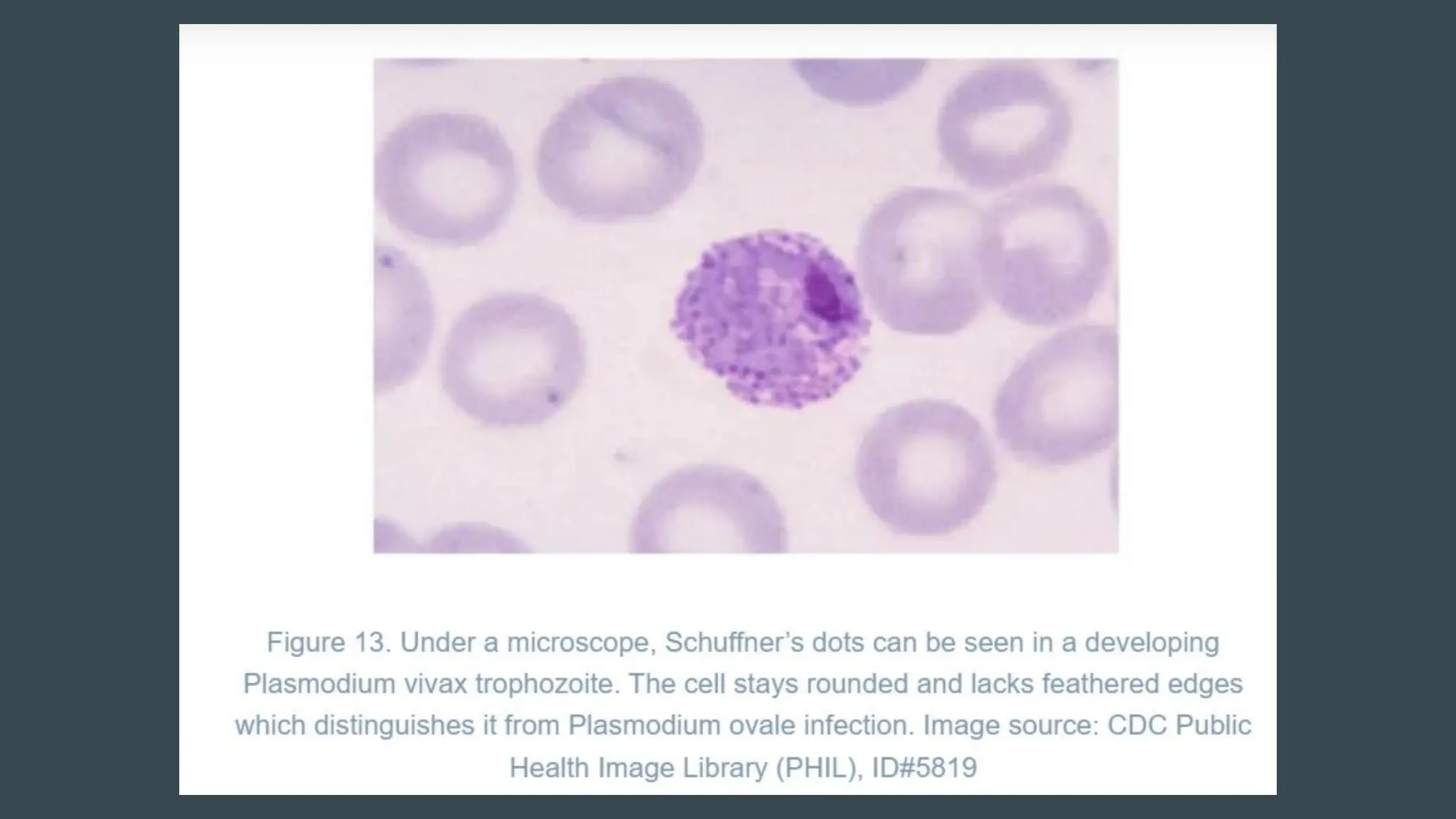 Malaria - Clinical Features and Diagnosis.pdf
