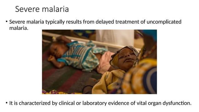 Malaria( introduction, treatment an complications of malaria) | PPT