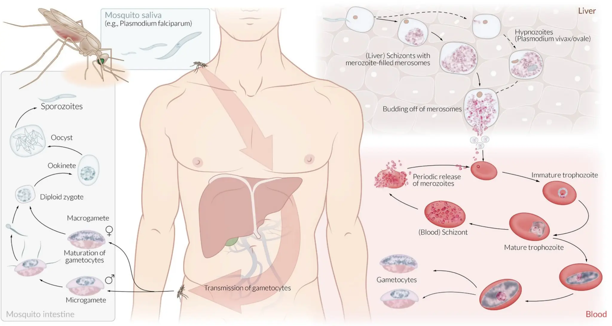 Malaria - AMBOSS Infection block .pdf….. | PDF