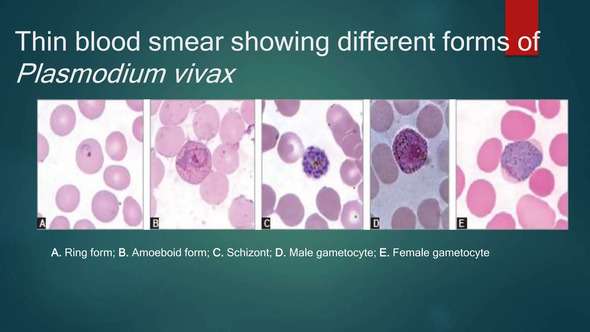 MALARIA- PowerPoint presentation pptx part 1 | PPTX