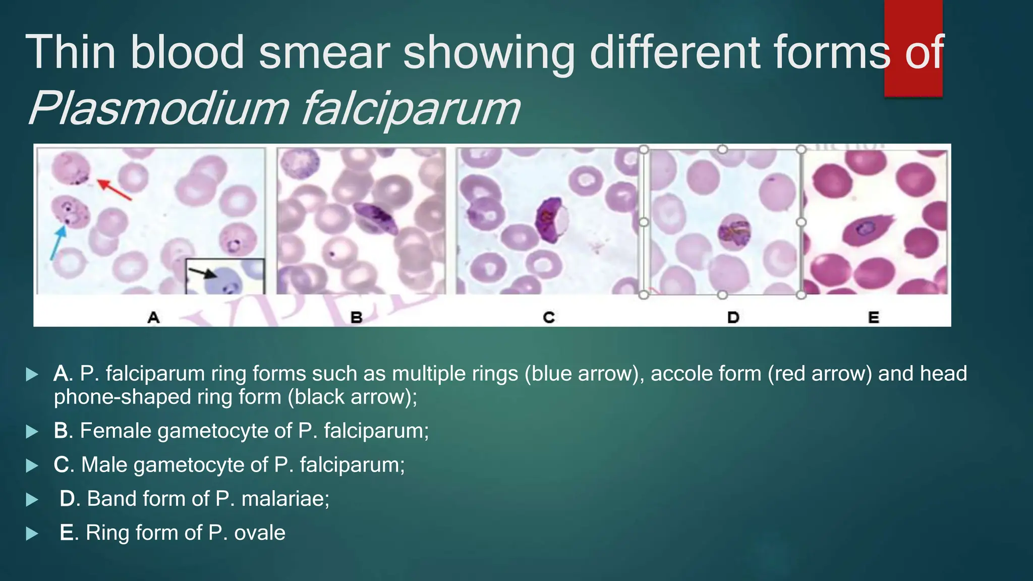 MALARIA- PowerPoint presentation pptx part 1 | PPTX
