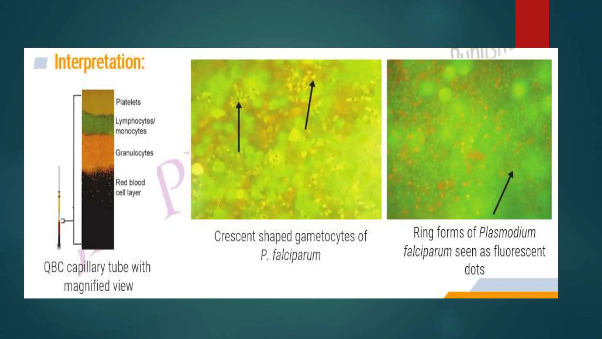 MALARIA- PowerPoint presentation pptx part 1 | PPTX